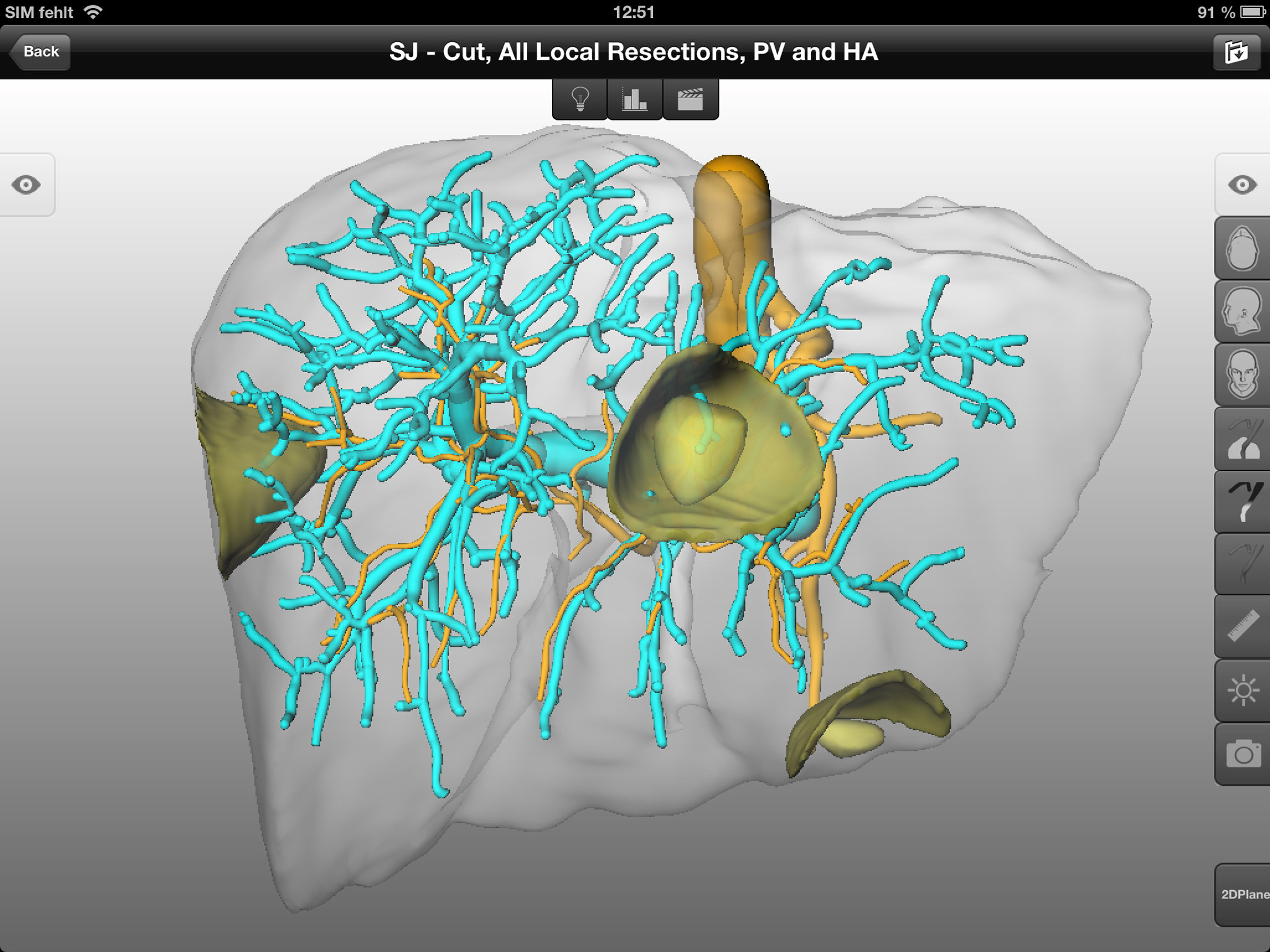 Improving Health Care through Mobile Medical Devices and Sensors ...