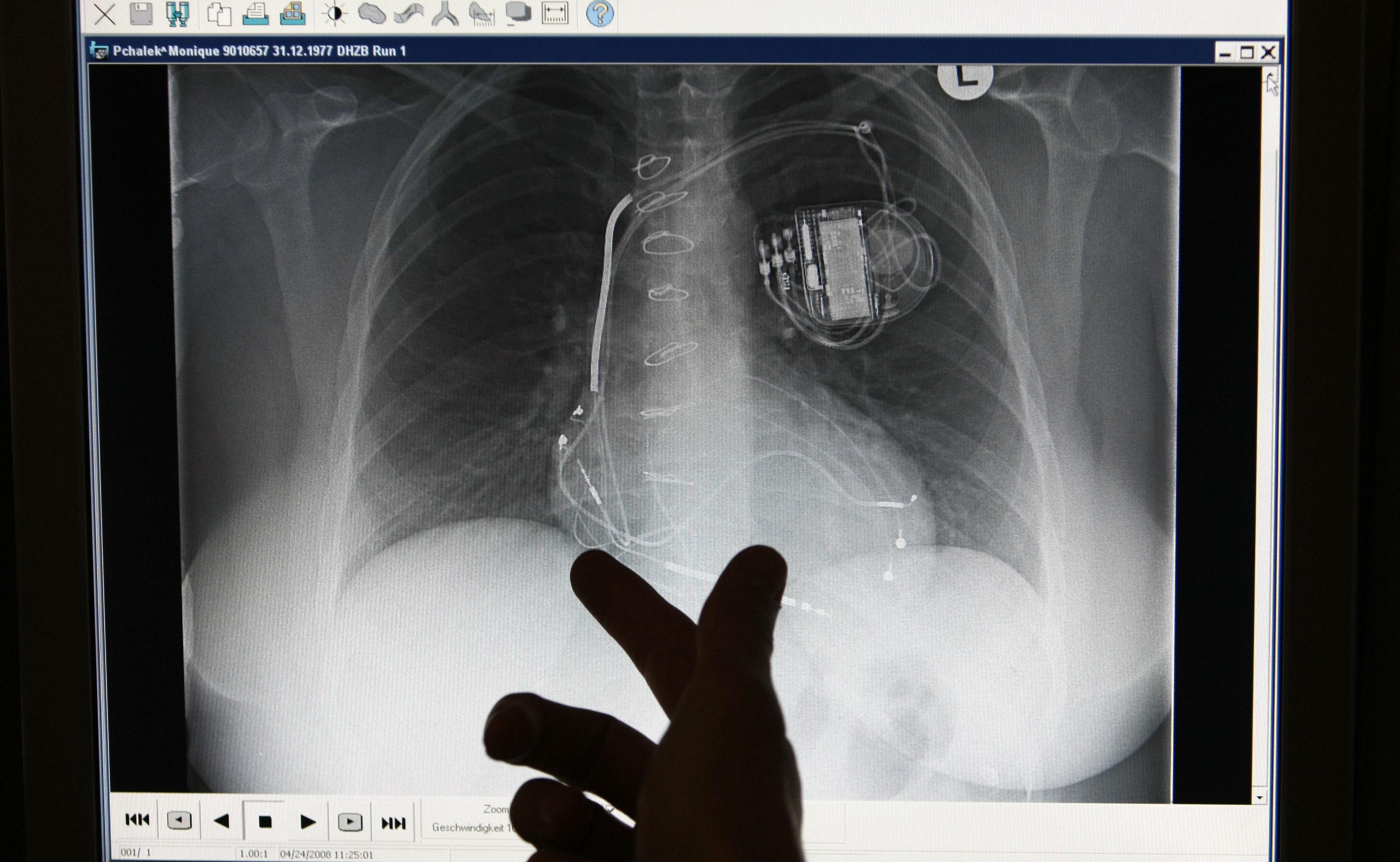 How to Launch the Country's First-Ever Medical Device Tracking System ...
