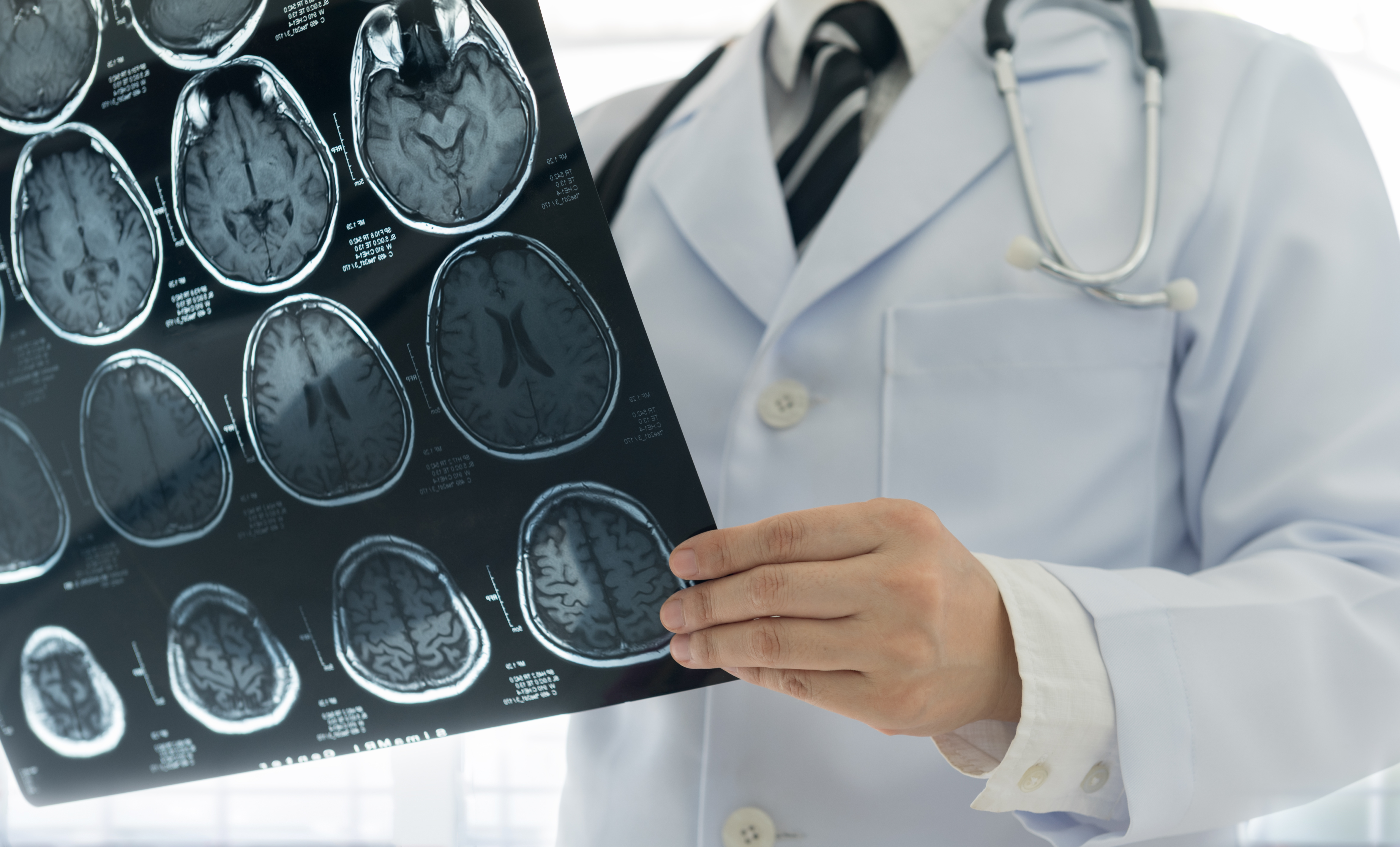 Brain health-directed policymaking: A new concept to strengthen ...